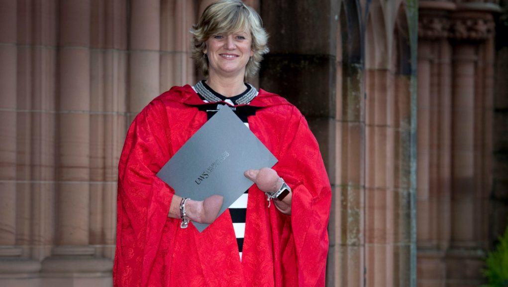 Double hand transplant patient Corinne Hutton to tackle North Coast 500 ...