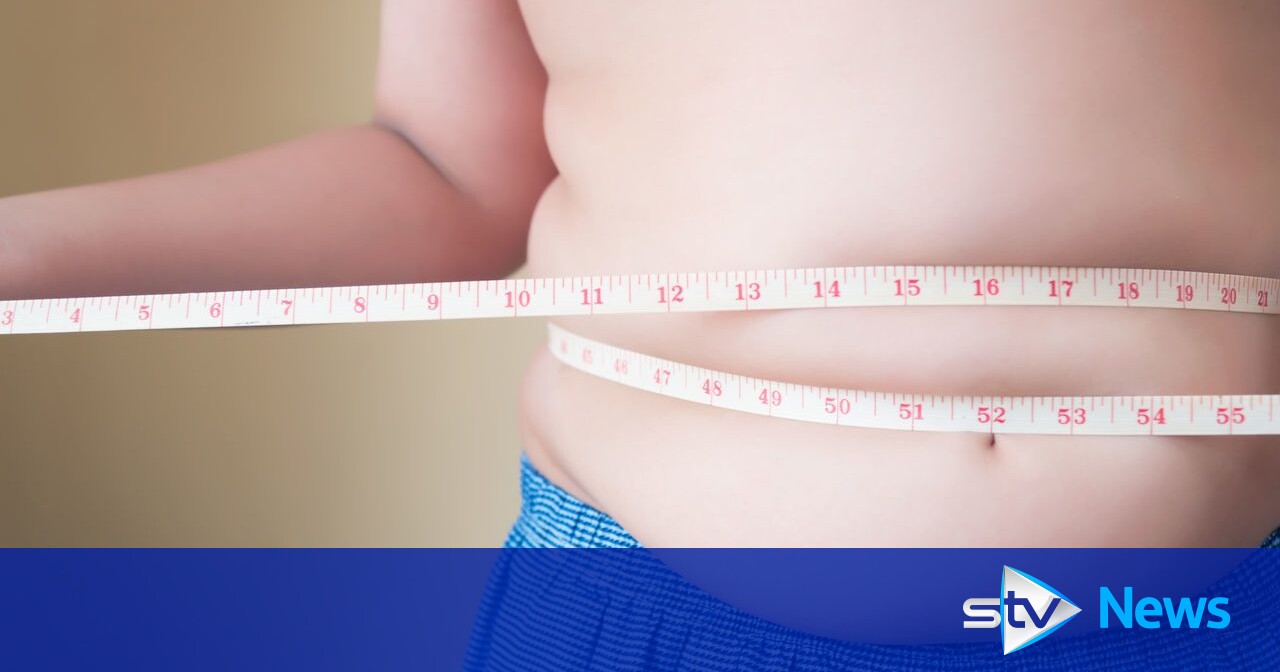 Scotland's childhood obesity 'rising' amid calls for tougher action on ...