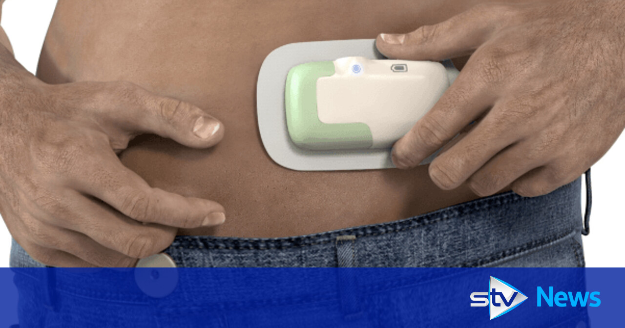 Heart failure device aims to provide 'hospital care at home' | STV News