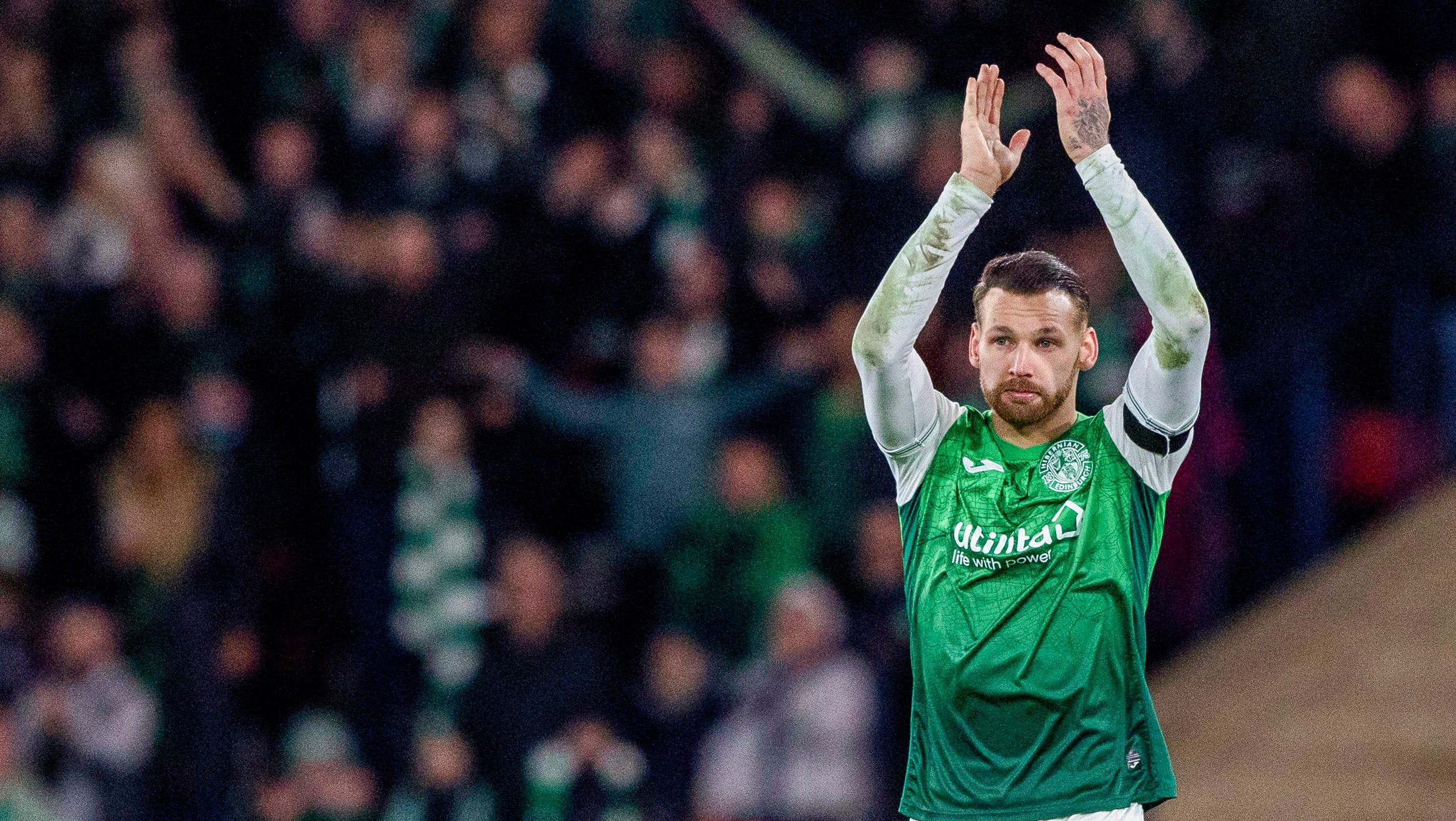 Hibernian’s Martin Boyle seeing specialist over leg injury ahead of ...
