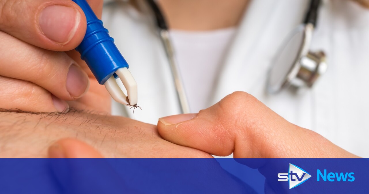 NHS 24 release advice on tick bites following an increase in calls ...