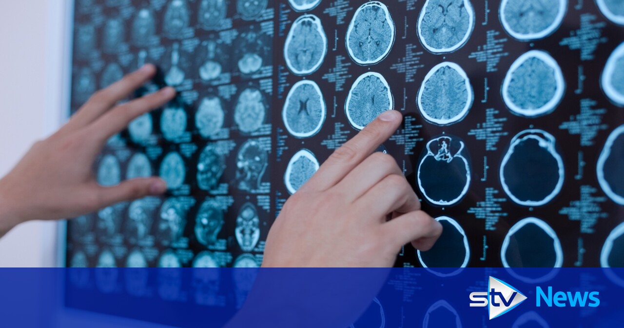 Cancer patients in Scotland first to trial new treatment for rare forms ...