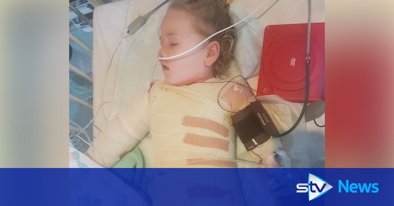 Mother issues warning to other parents after toddler suffered ...