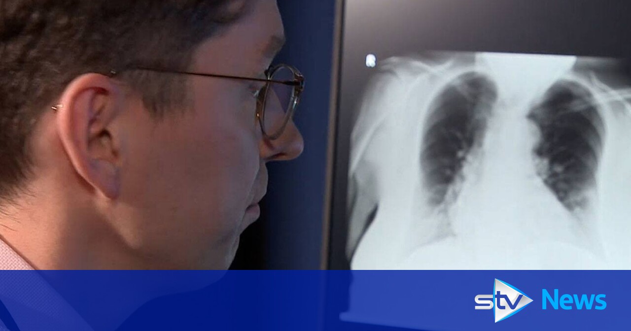 NHS Grampian radiology department trialling artificial intelligence ...