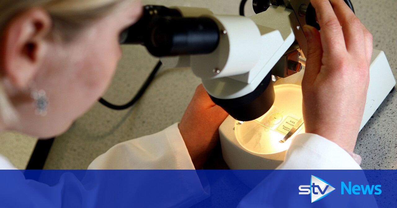 Glasgow University scientists target ‘first stop’ of prostate cancer ... Glasgow University scientists target ‘first stop’ of prostate cancer ...
