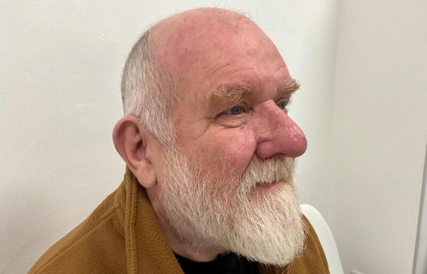Scots Navy veteran 'rejoins human race' after surgery on nose he ...