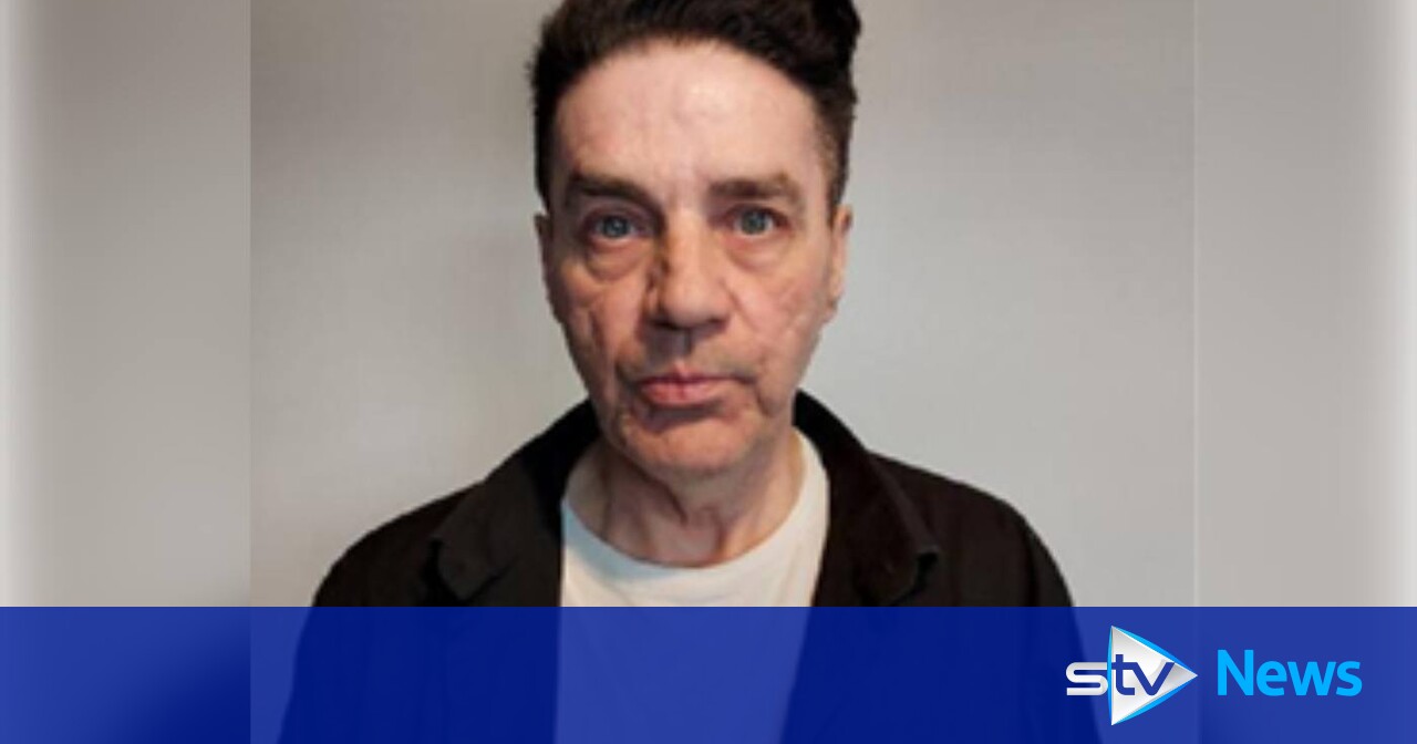 Concerns grow for man, 62, missing from Glasgow for two days | STV News