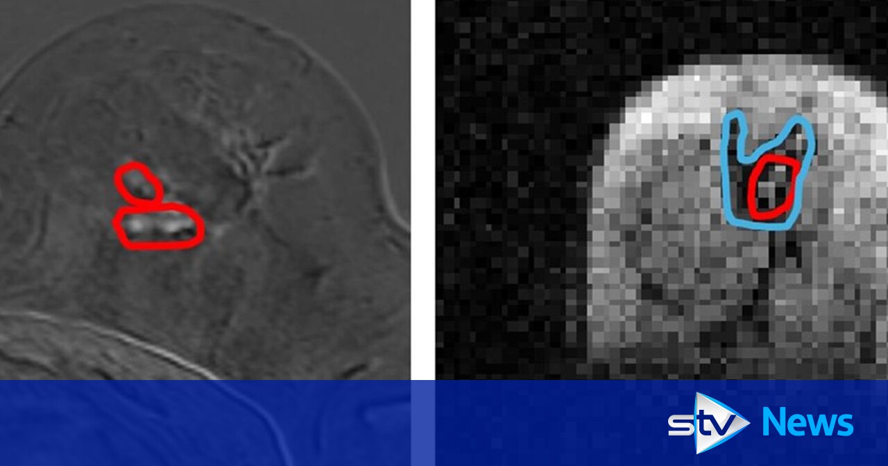World-first technology developed at University of Aberdeen can see ...
