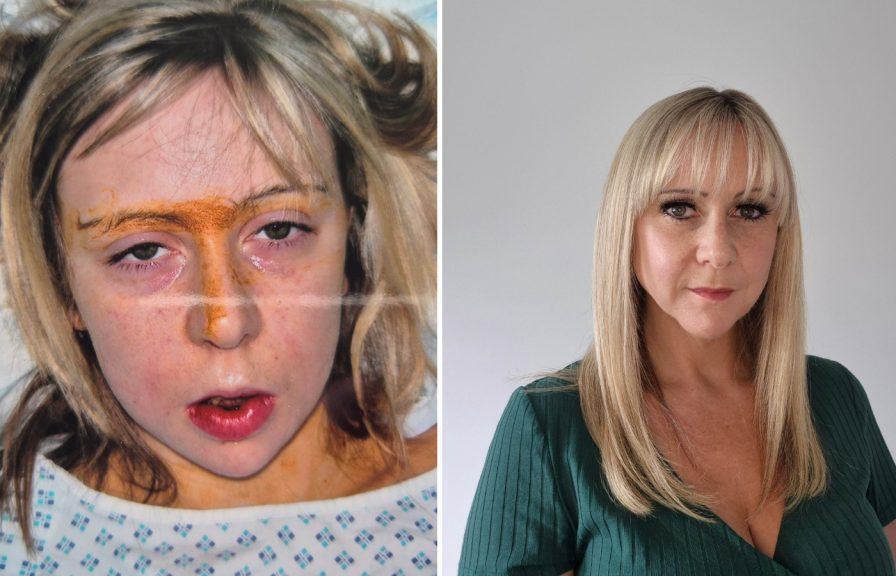 Arbroath butcher crowned UK's first black pudding 'Champion of ...