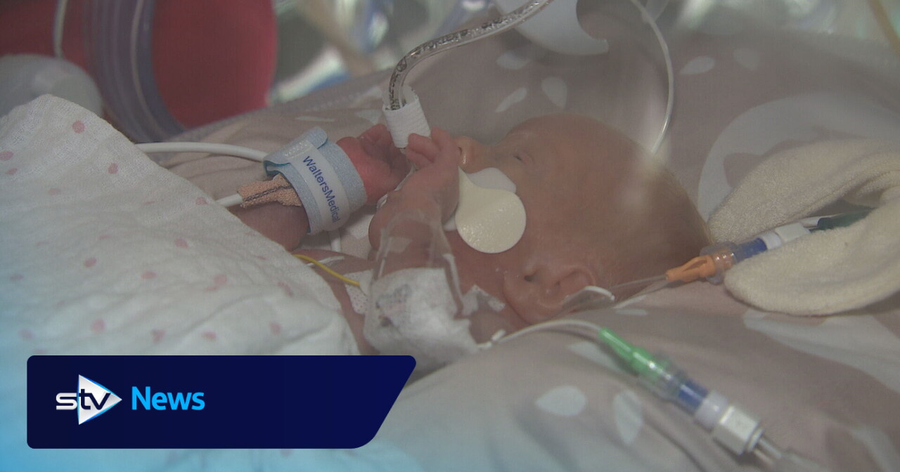 Plans to downgrade Wishaw General's award-winning neo-natal unit ...