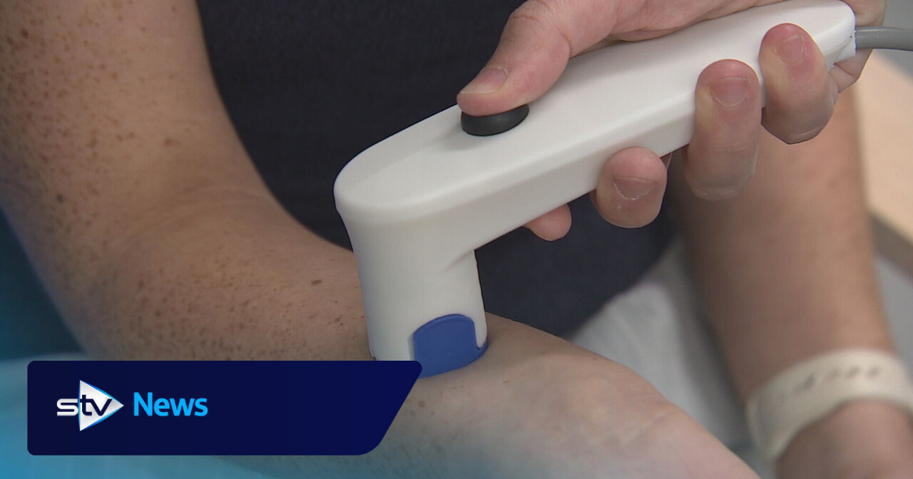 'Revolutionary' skin sensor developed by Heriot Watt University could ...