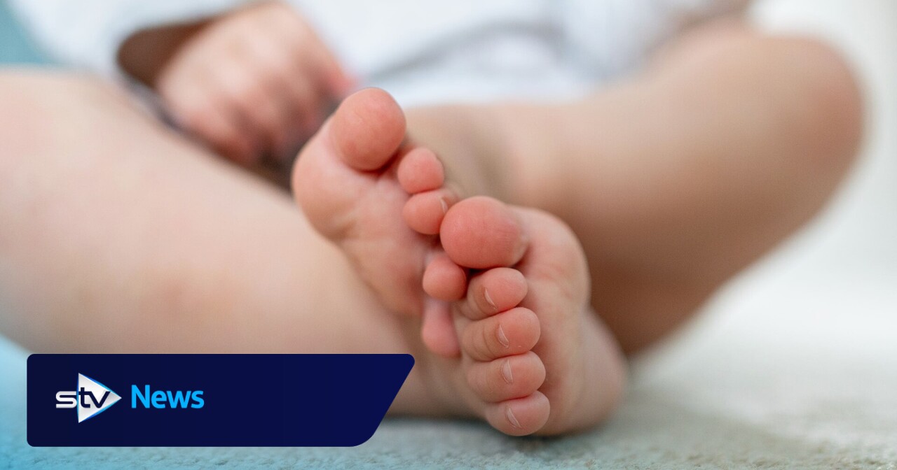 Rollout of ‘simple’ genetic test to help prevent deafness in babies in ...