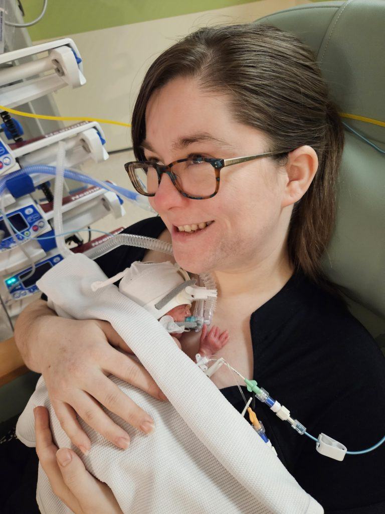 'Miracle’ baby celebrates first Christmas after life-saving blood ...