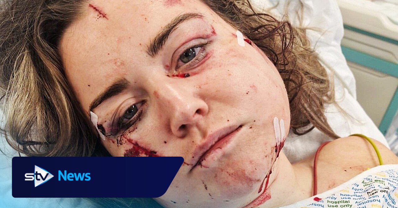 Man attempted to murder ex with dance trophy and kitchen knife | STV News